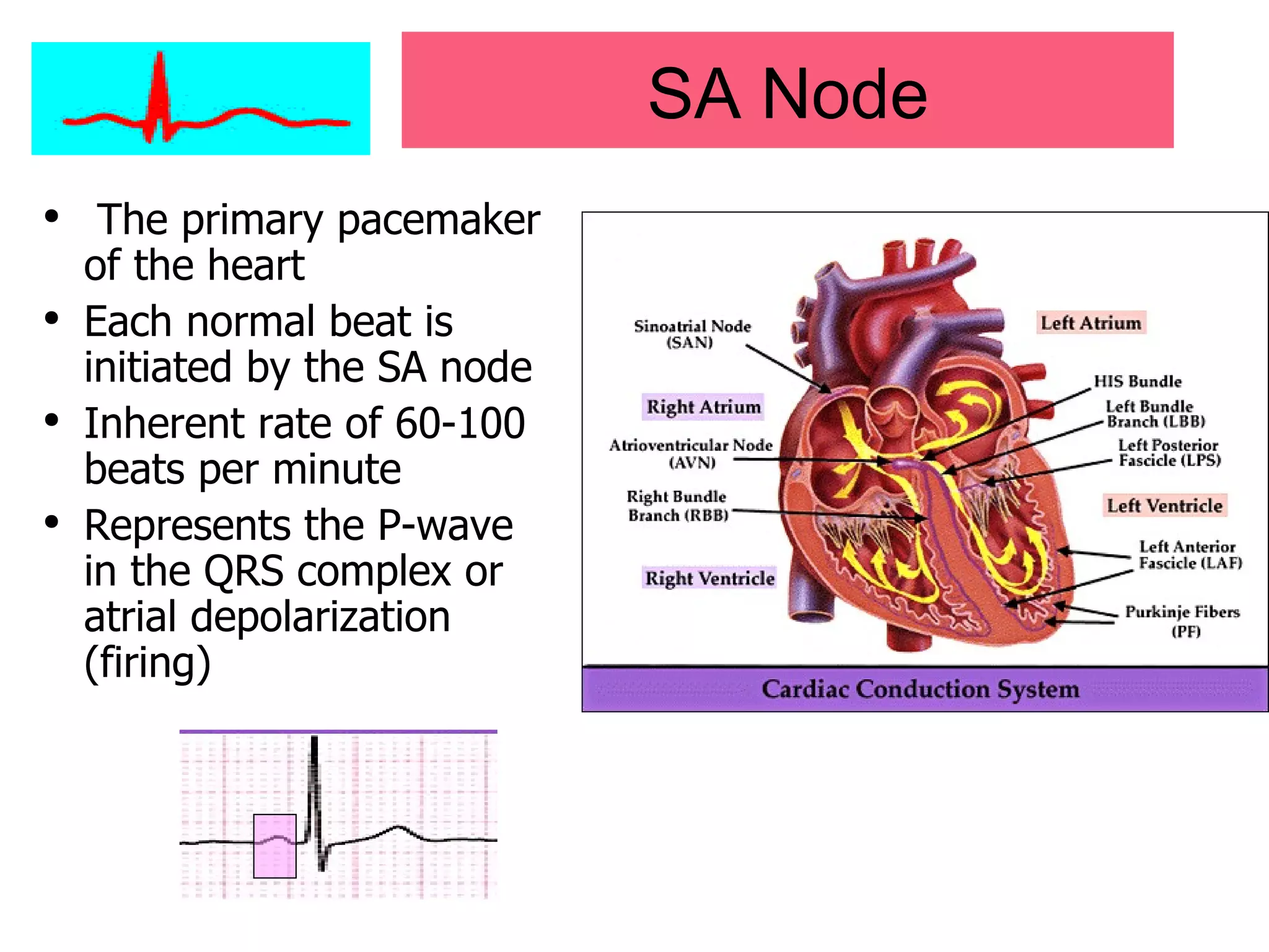 Cardiac arrhythmias | PPT