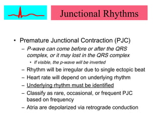 Cardiac arrhythmias | PPT