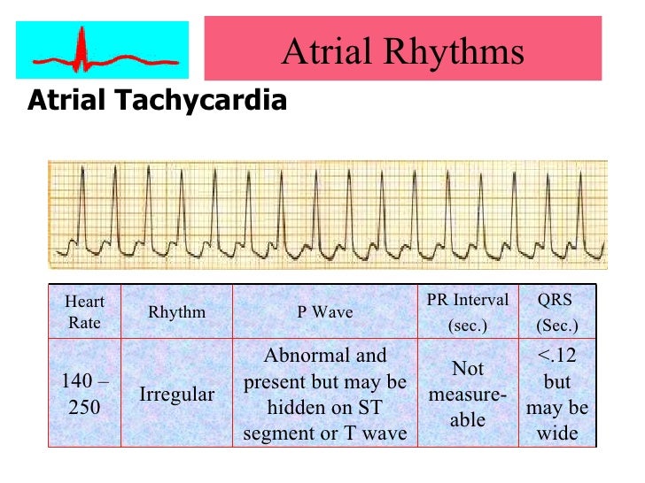 Cardiac arrhythmias