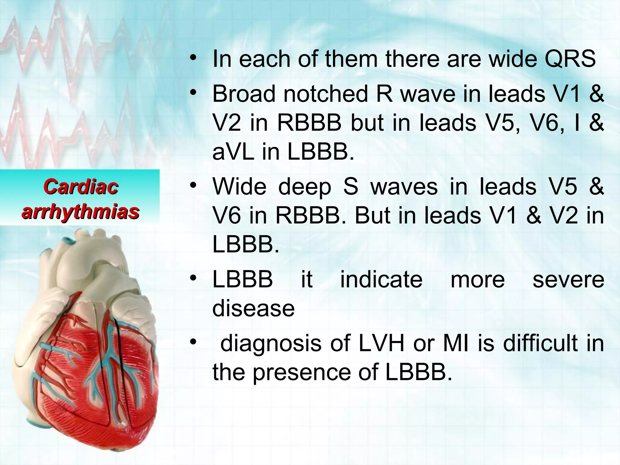 Cardiac arrhythmias | PPT