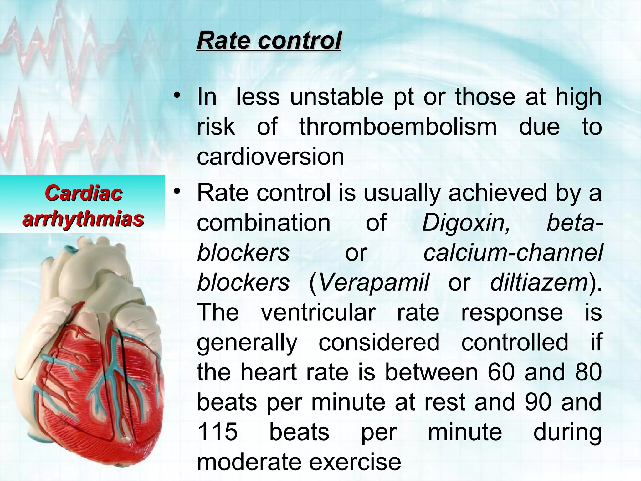 Cardiac arrhythmias | PPT