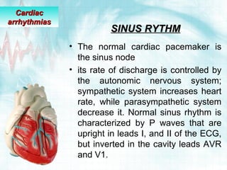 Cardiac arrhythmias | PPT