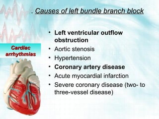 Cardiac arrhythmias | PPT