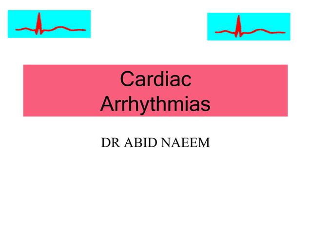 Cardiac arrhythmias | PPTX | Heart and Cardiovascular Diseases | Diseases and Conditions