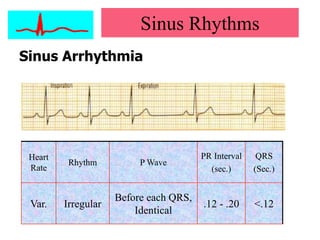 Cardiac arrhythmias | PPTX