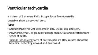 Cardiac arrhythmias | PPTX