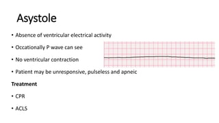 Cardiac arrhythmias | PPTX
