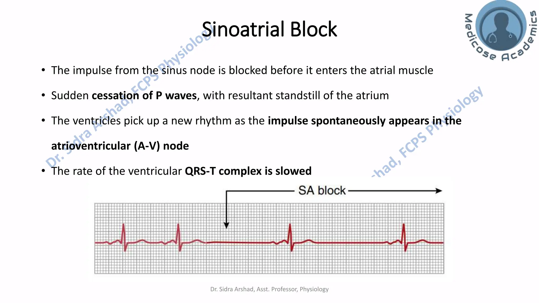 Interpretation of ECG - Cardiac Arrhythmias | PPTX