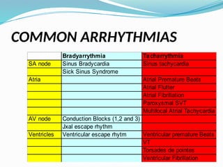 Cardiac Arrhythmias, Pathophysiology Lecture (Cardiology). pptx | PPTX