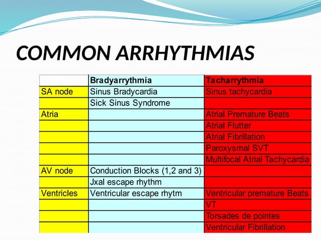 Cardiac Arrhythmias, Pathophysiology Lecture (Cardiology). pptx | PPTX