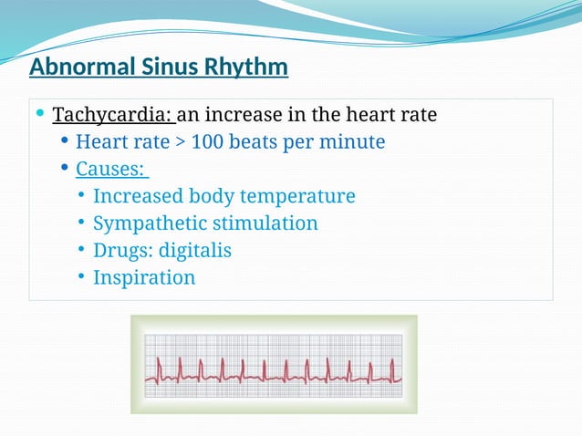 Cardiac Arrhythmias, Pathophysiology Lecture (Cardiology). pptx | PPTX
