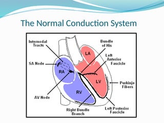 Cardiac Arrhythmias, Pathophysiology Lecture (Cardiology). pptx | PPTX