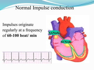 Cardiac Arrhythmias, Pathophysiology Lecture (Cardiology). pptx | PPTX