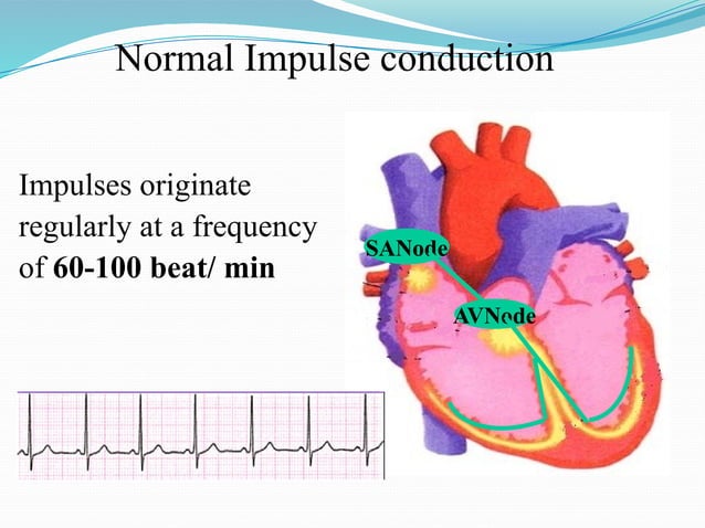Cardiac Arrhythmias, Pathophysiology Lecture (Cardiology). pptx | PPTX