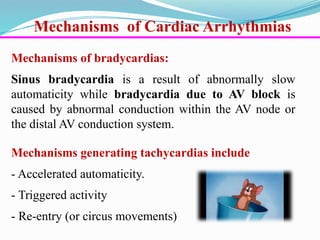 Cardiac Arrhythmias, Pathophysiology Lecture (Cardiology). pptx | PPTX