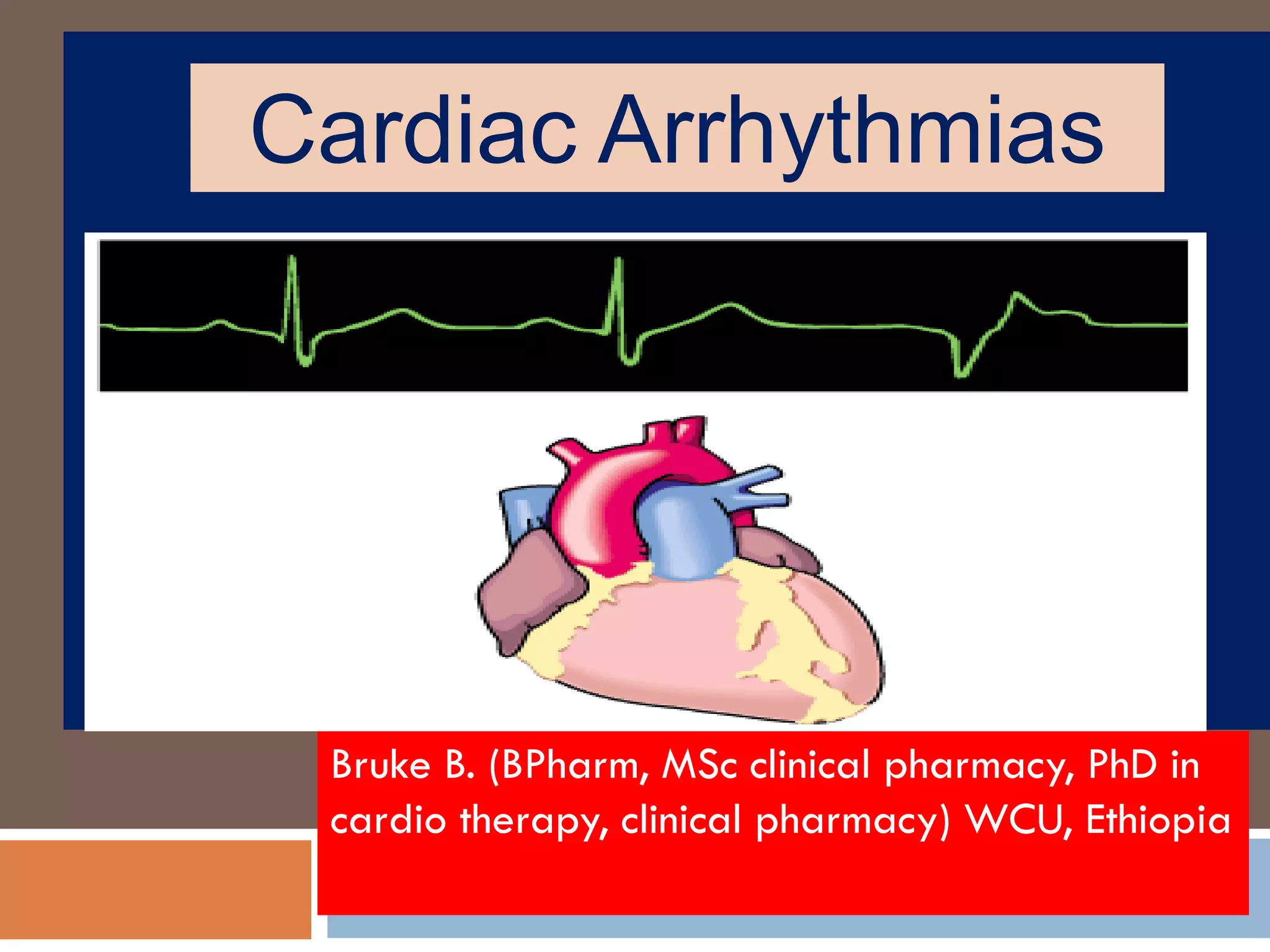 Cardiac Arrhythmias (1).pdf Cardiac Arrhythmias (1).pdf