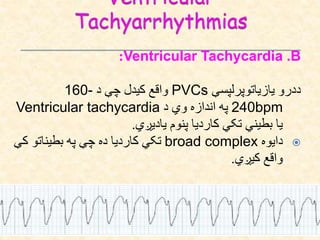 Cardiac arrhythmias | PPT