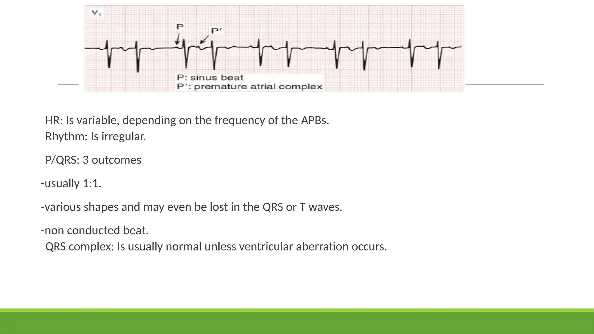 Arrhythmias vascular and hemorrhage (2) (1).pptx