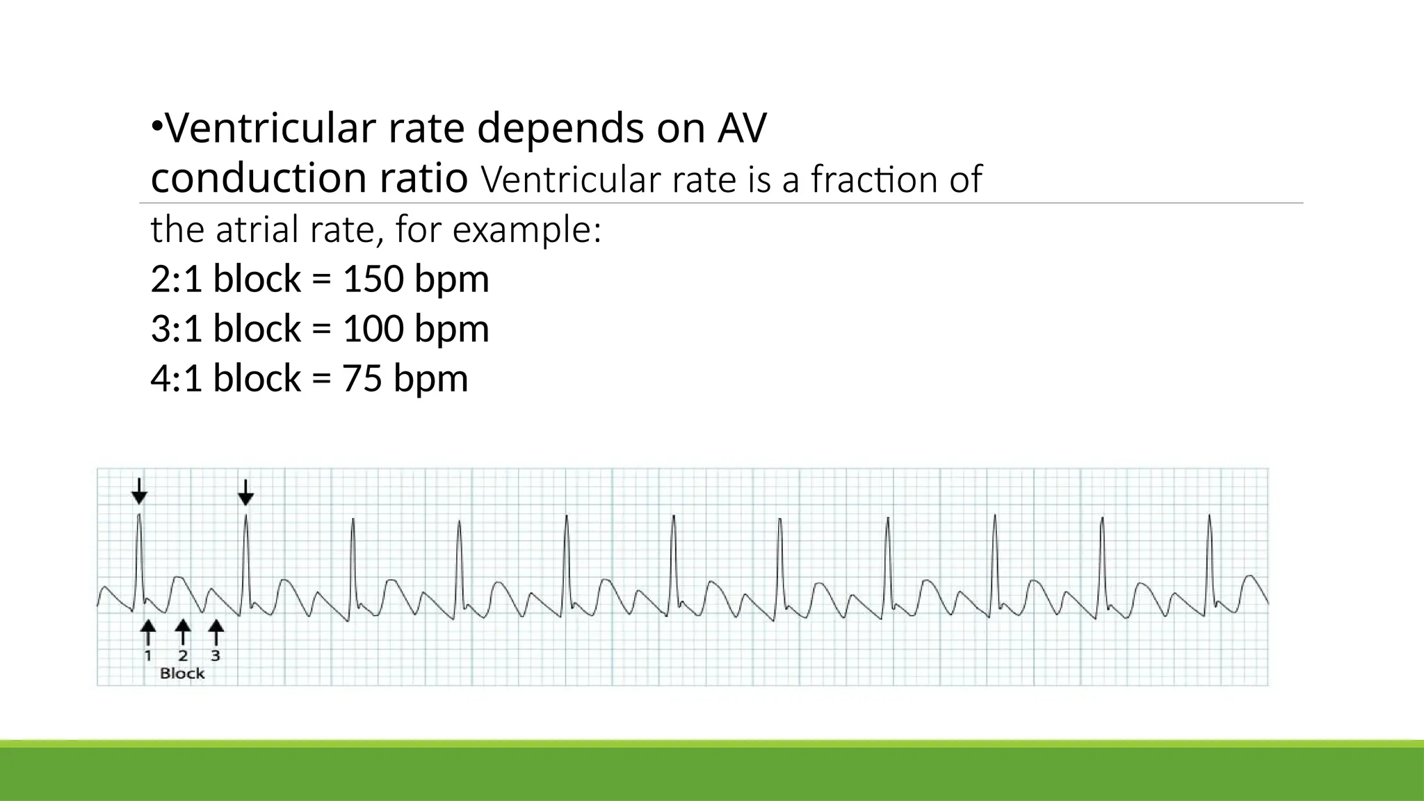 Arrhythmias vascular and hemorrhage (2) (1).pptx