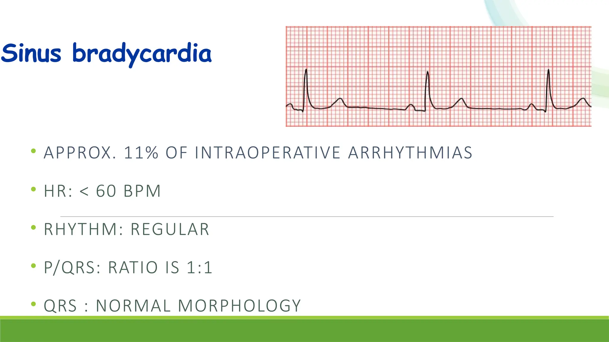 Arrhythmias vascular and hemorrhage (2) (1).pptx
