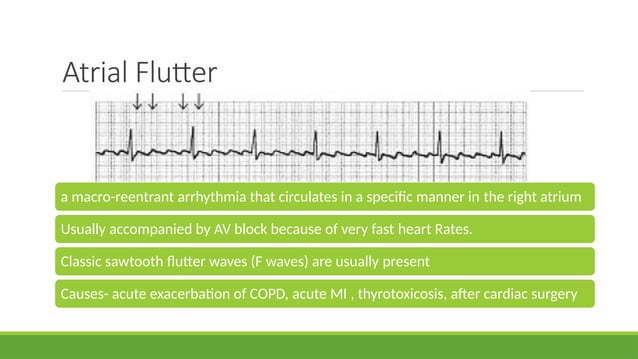 Arrhythmias vascular and hemorrhage (2) (1).pptx