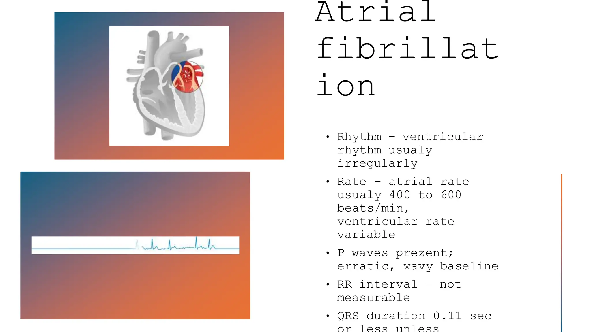Cardiac Arrhythmias and aortic-anesurism.pptx | Heart and Cardiovascular Diseases | Diseases and ...