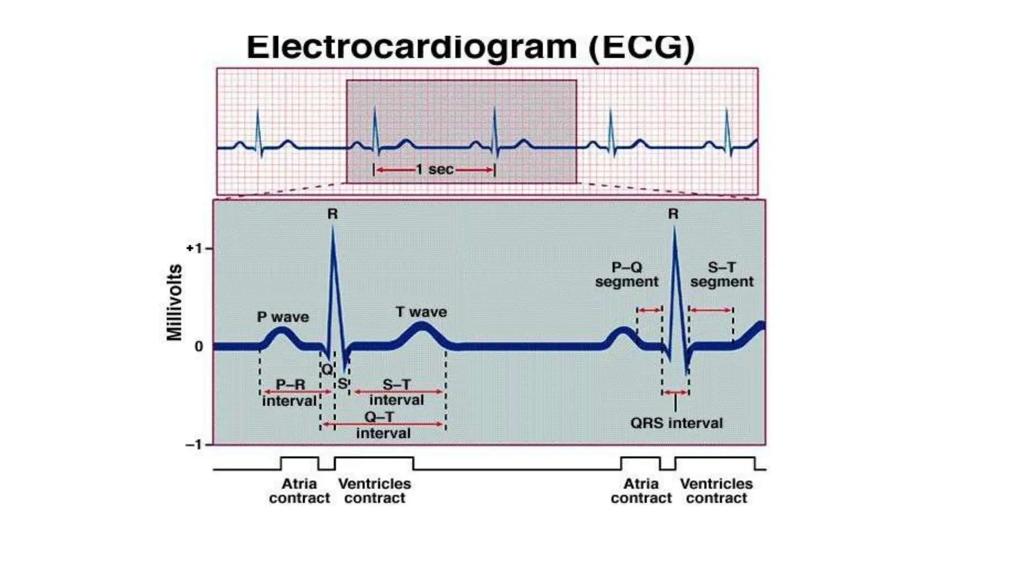 Cardiac Arrhythmias and aortic-anesurism.pptx | Heart and Cardiovascular Diseases | Diseases and ...