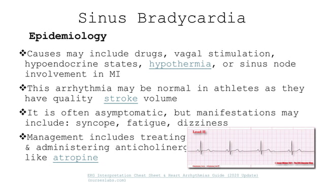 Cardiac Arrhythmias and aortic-anesurism.pptx | Heart and Cardiovascular Diseases | Diseases and ...