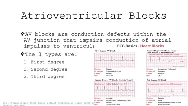 Cardiac Arrhythmias and aortic-anesurism.pptx | Heart and Cardiovascular Diseases | Diseases and ...