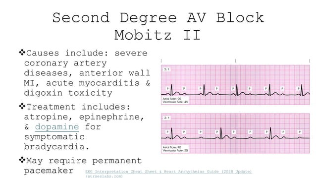 Cardiac Arrhythmias and aortic-anesurism.pptx | Heart and Cardiovascular Diseases | Diseases and ...