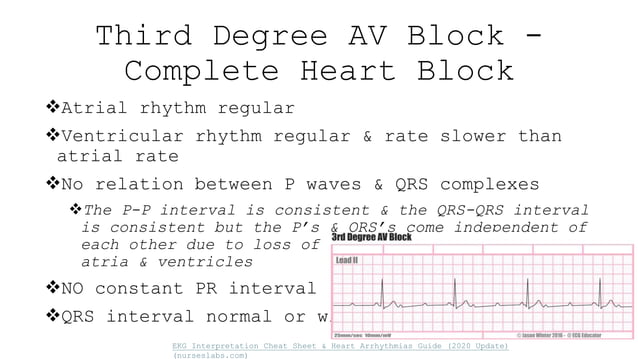 Cardiac Arrhythmias and aortic-anesurism.pptx | Heart and Cardiovascular Diseases | Diseases and ...