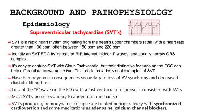 Cardiac Arrhythmias and aortic-anesurism.pptx | Heart and Cardiovascular Diseases | Diseases and ...