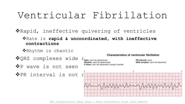 Cardiac Arrhythmias and aortic-anesurism.pptx | Heart and Cardiovascular Diseases | Diseases and ...