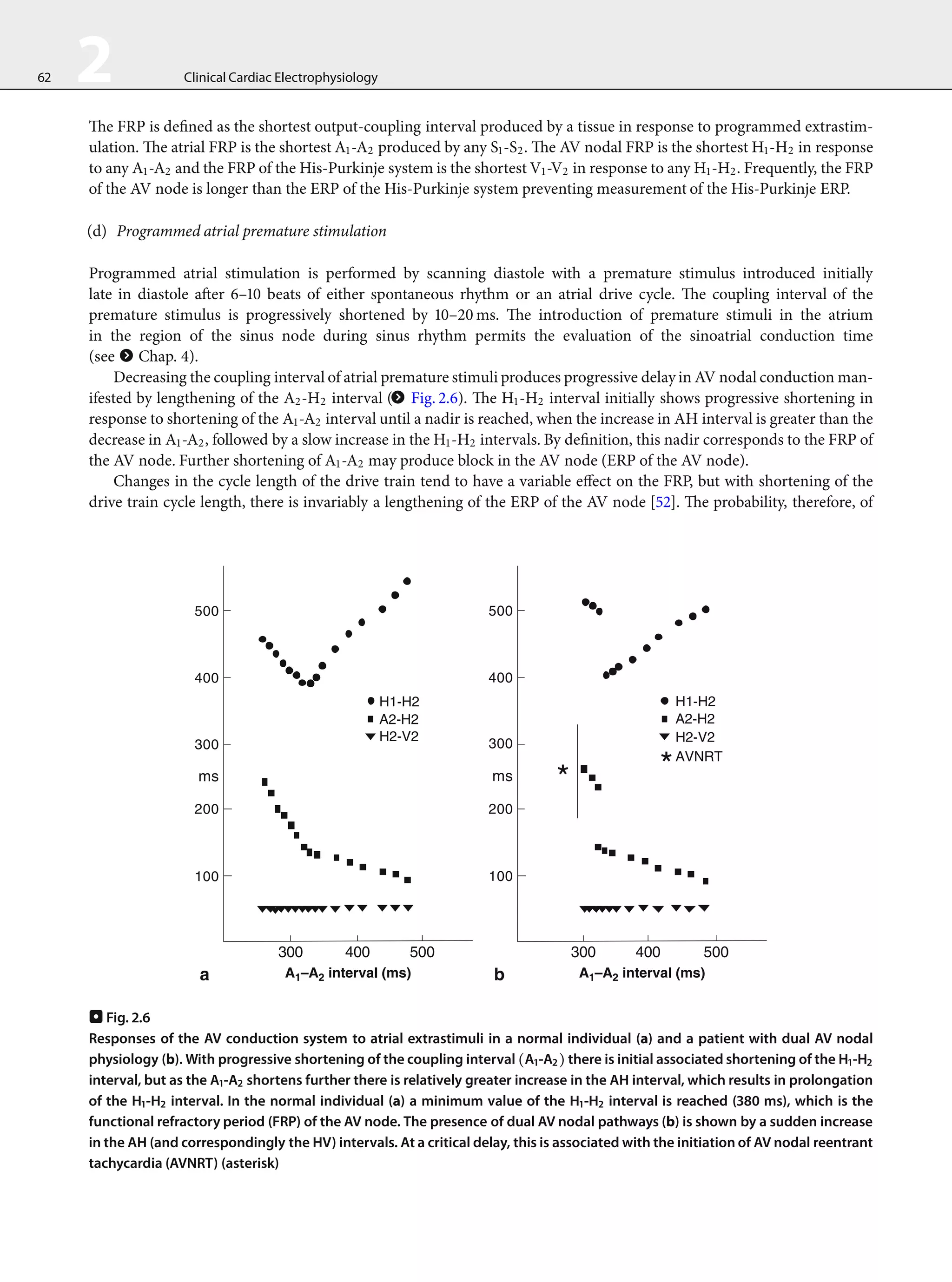 Cardiac arrhythmias and mapping techniques | PDF