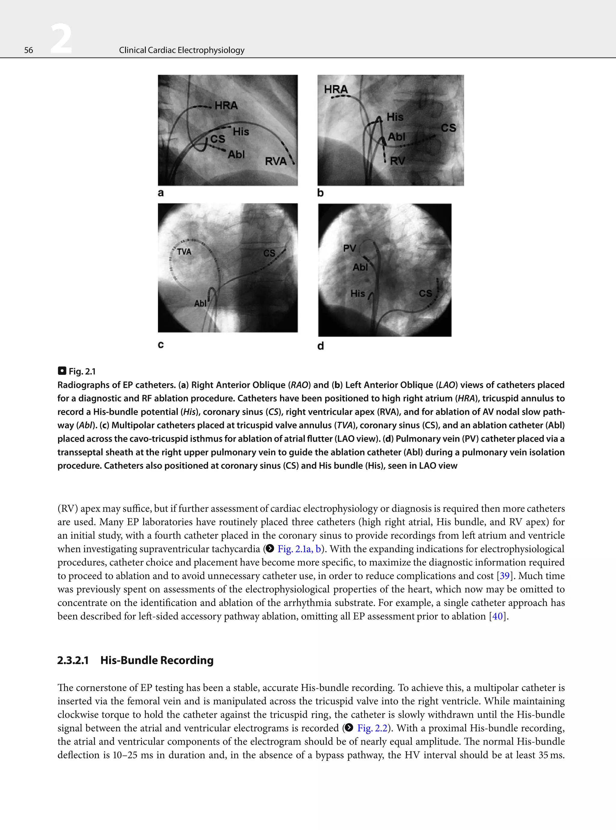 Cardiac arrhythmias and mapping techniques | PDF