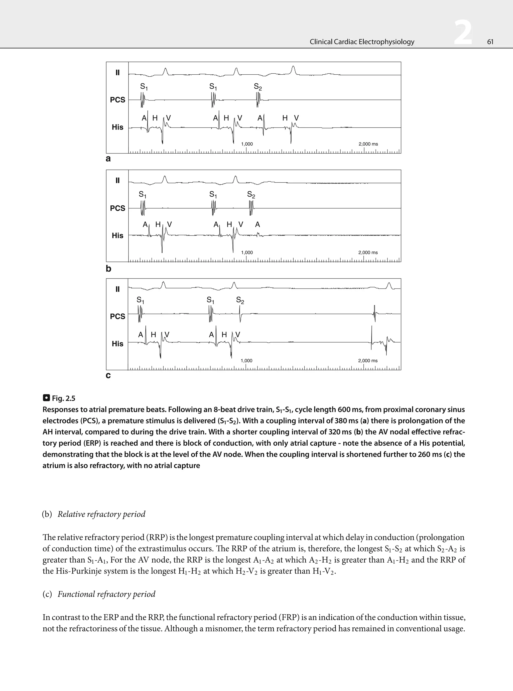 Cardiac arrhythmias and mapping techniques | PDF