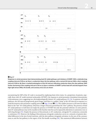 Cardiac arrhythmias and mapping techniques | PDF