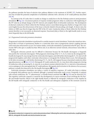 Cardiac arrhythmias and mapping techniques | PDF
