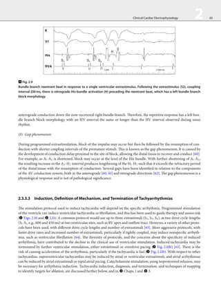 Cardiac arrhythmias and mapping techniques | PDF