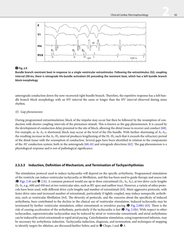 Cardiac arrhythmias and mapping techniques | PDF