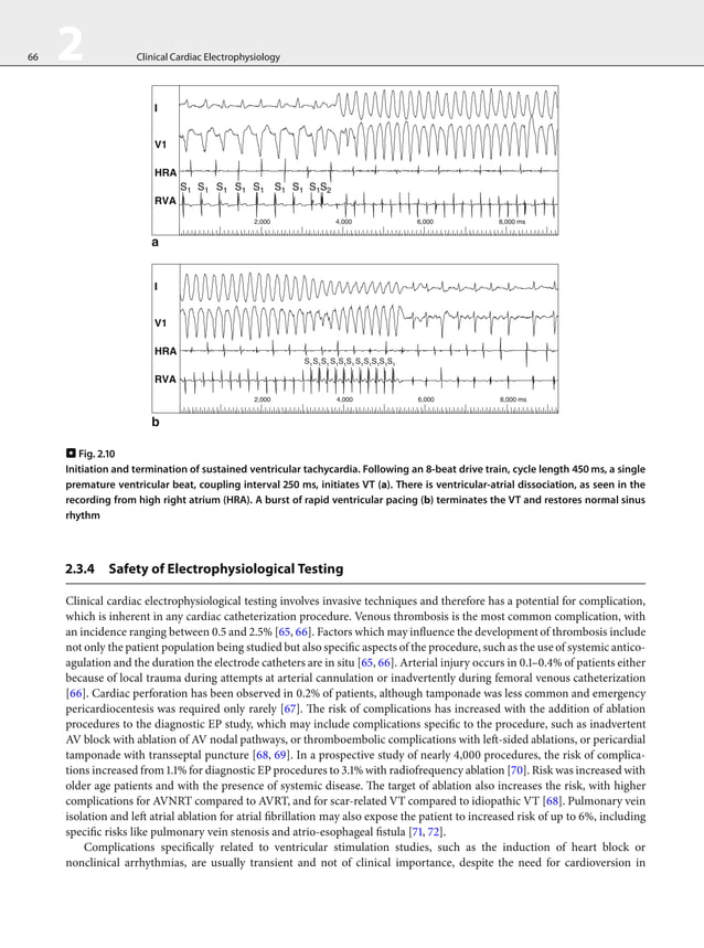 Cardiac arrhythmias and mapping techniques | PDF