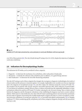 Cardiac arrhythmias and mapping techniques | PDF