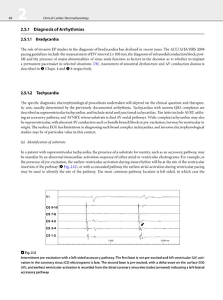 Cardiac arrhythmias and mapping techniques | PDF