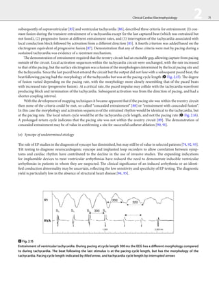 Cardiac arrhythmias and mapping techniques | PDF