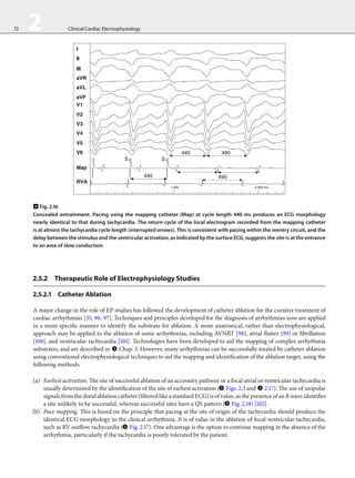 Cardiac arrhythmias and mapping techniques | PDF