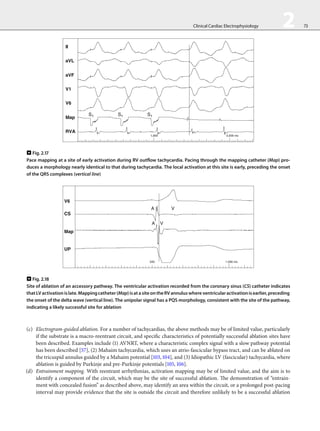 Cardiac arrhythmias and mapping techniques | PDF