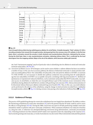 Cardiac arrhythmias and mapping techniques | PDF