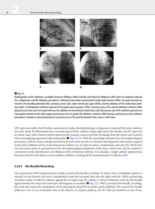 Cardiac arrhythmias and mapping techniques | PDF