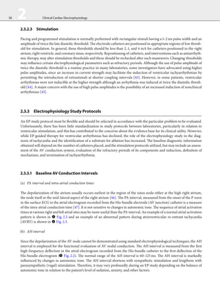 Cardiac arrhythmias and mapping techniques | PDF
