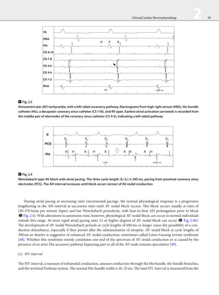 Cardiac arrhythmias and mapping techniques | PDF